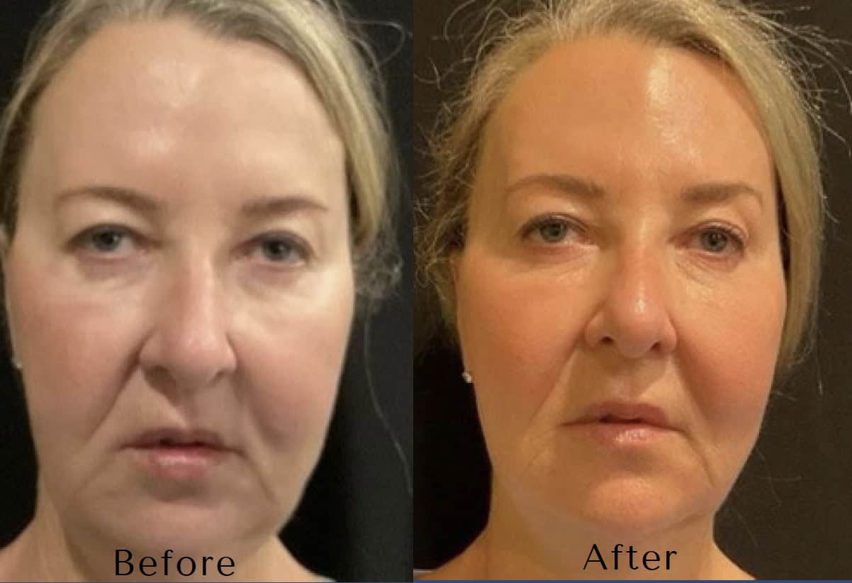 Monthly Specials - BodyWise Specialists